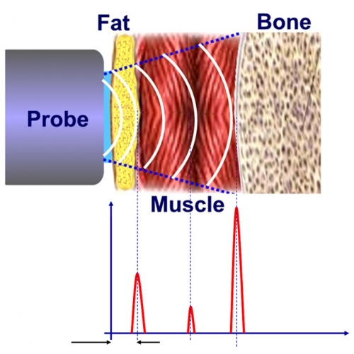BodyMetrix Commercial Unit – Bodytastic